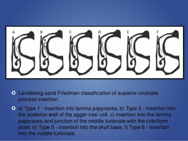 Peroperative PNS CT - A 10-steps evaluation