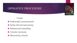 Peroral endoscopic myotomy | PPTX