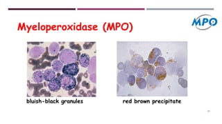 Myeloperoxidases Stains | PDF