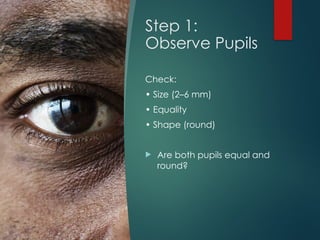 How to Perform a PERRLA Eye Assessment: Step-by-Step Guide for Health ...