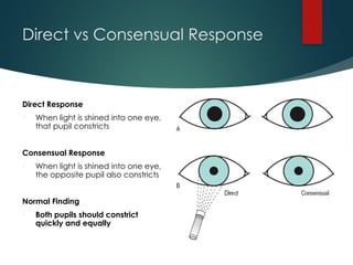How to Perform a PERRLA Eye Assessment: Step-by-Step Guide for Health ...