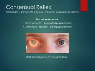 How to Perform a PERRLA Eye Assessment: Step-by-Step Guide for Health ...
