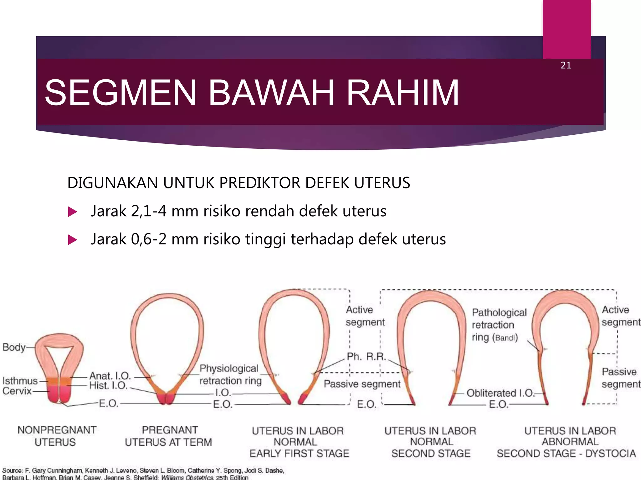 Persalinan dengan bekas sc | PPTX