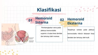 Patofisiologis penyakit hemoroid dan gejala | PPTX