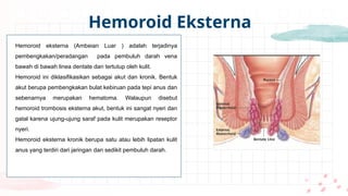 Patofisiologis penyakit hemoroid dan gejala | PPTX