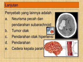 Presentasi Tekanan Intrakranial | PPTX