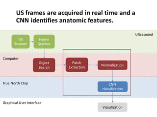 Deep Learning: the future of ultrasound | PDF