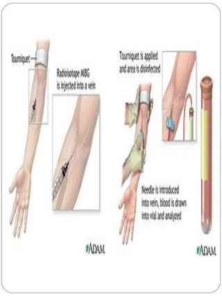Persiapan pengambilan spesimen.bag.4 | PPT
