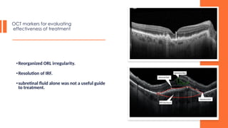 persistent subretinal fluid in best dystrophy | PPTX