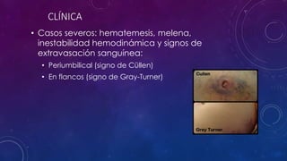 PANCREATITIS | PPTX