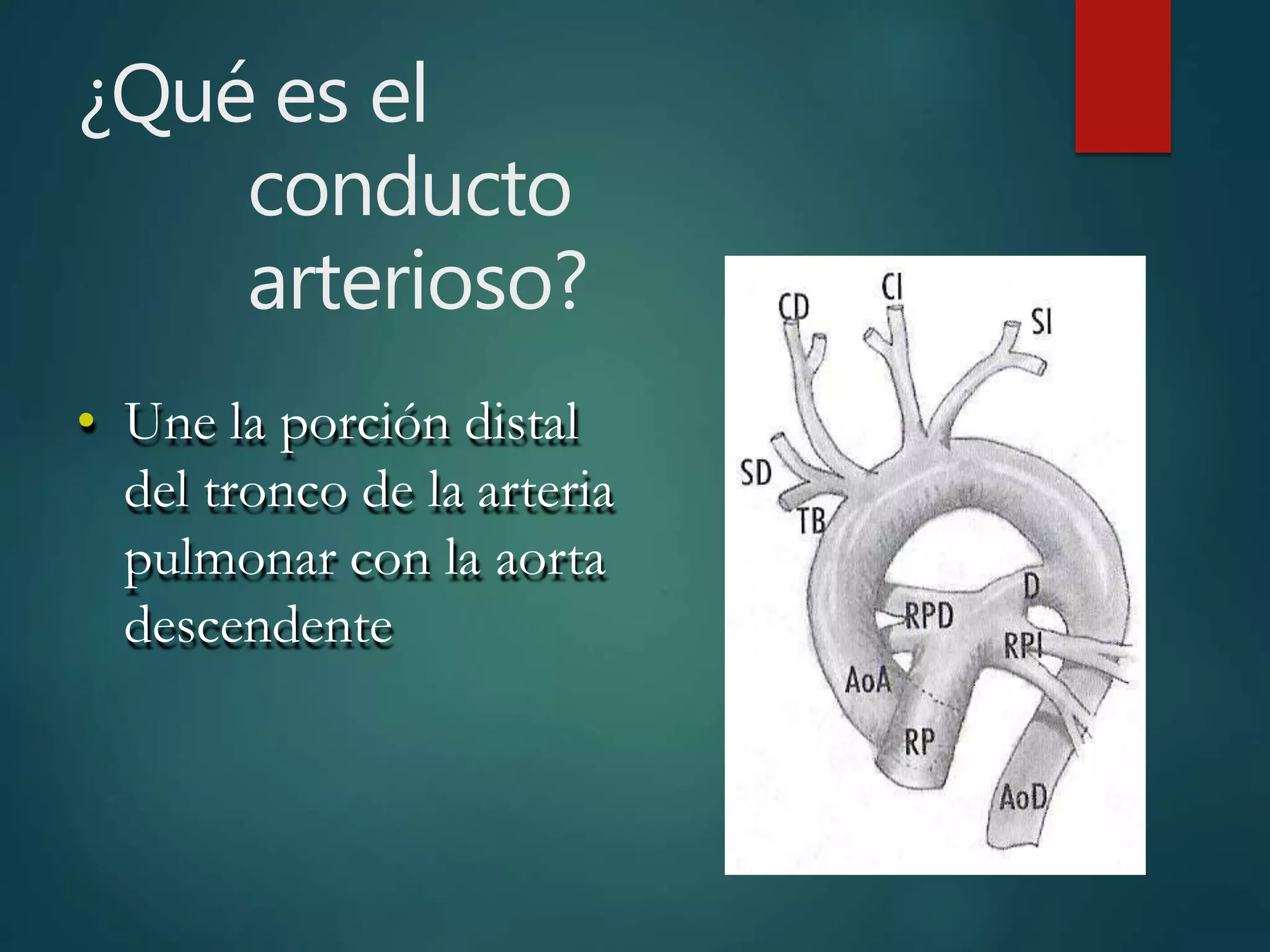 Persistencia del conducto arterioso | PPTX