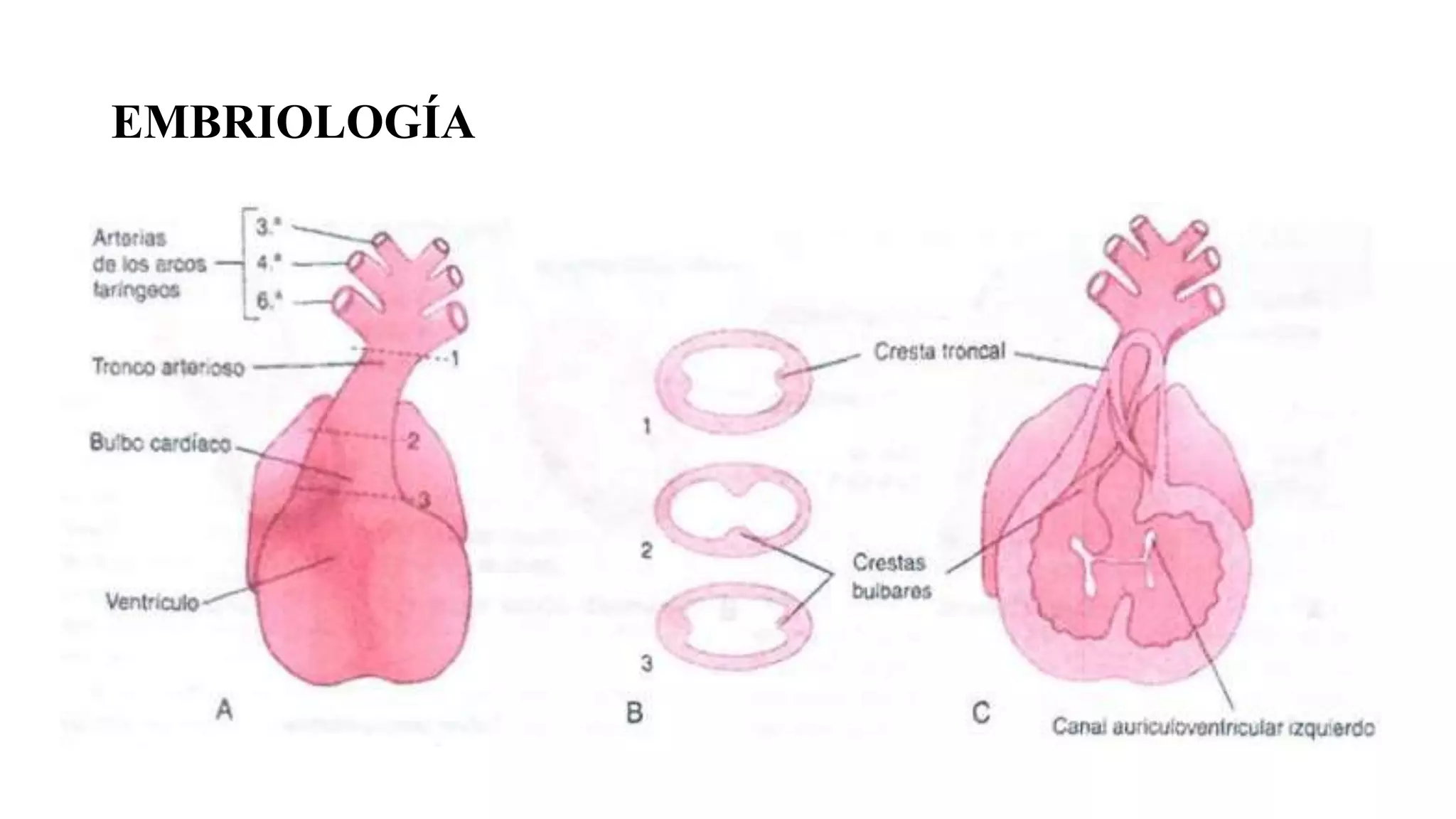 Persistencia del Conducto Arterioso | PPT