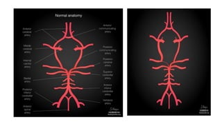 PERSISTENT FETAL CIRCULATION OF BRAIN.pptx