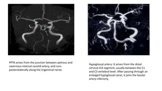PERSISTENT FETAL CIRCULATION OF BRAIN.pptx