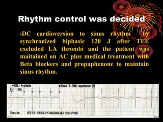 Persistent Atrial Fibrillation Management: Case preventation | PPT