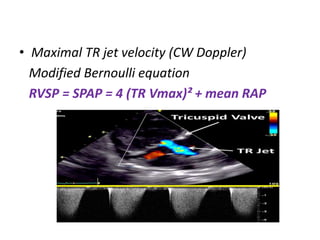 Persistent pulmonary hypertension of newborn PPHN | PPTX