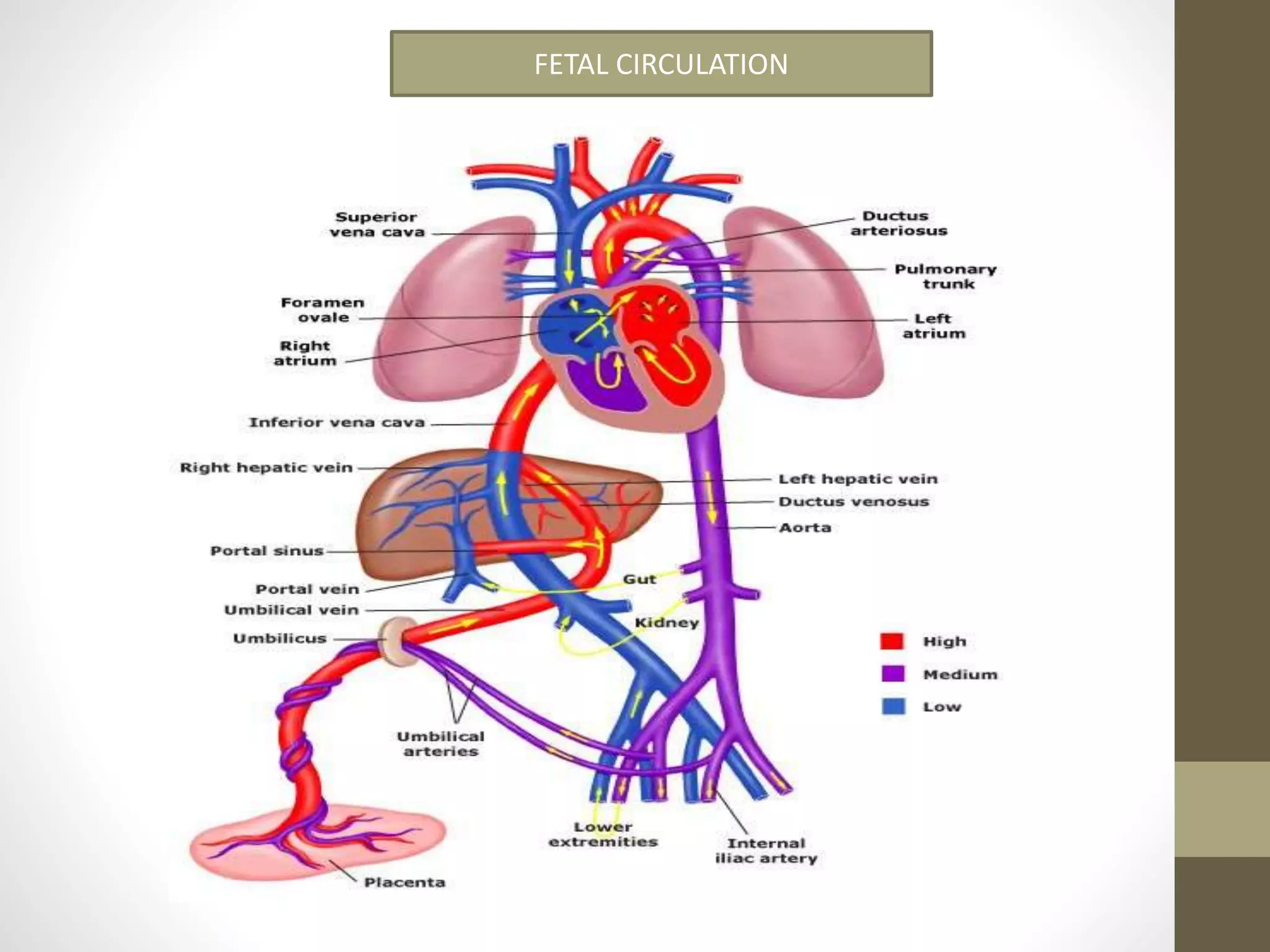 Persistent pulmonary hypertension(pphn) | PPTX