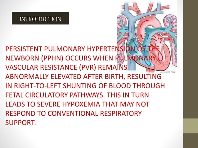 Persistent pulmonary hypertension(pphn) | PPTX