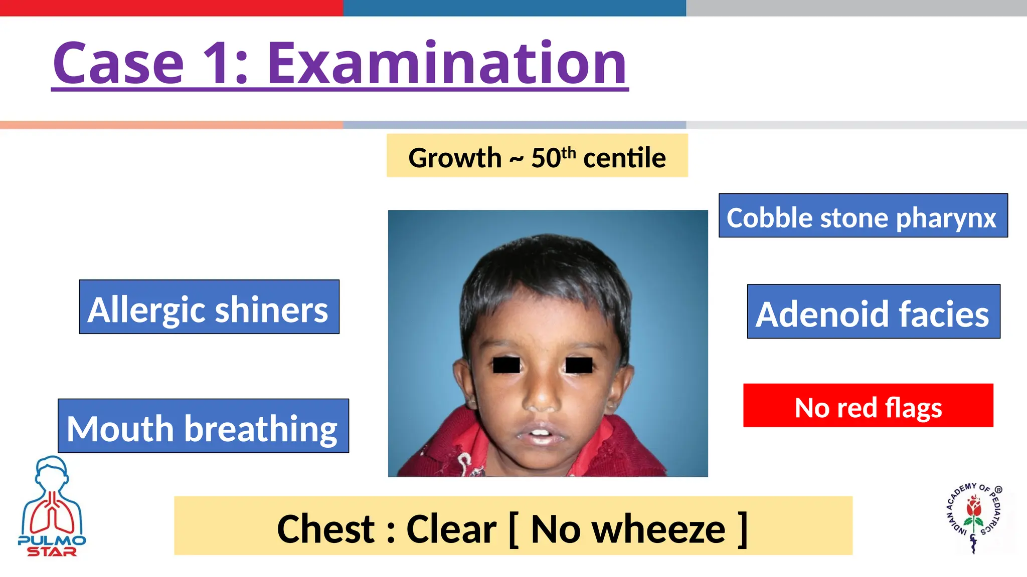 "Persistent and Recurrent Cough: Causes, Diagnosis, and Management in ...