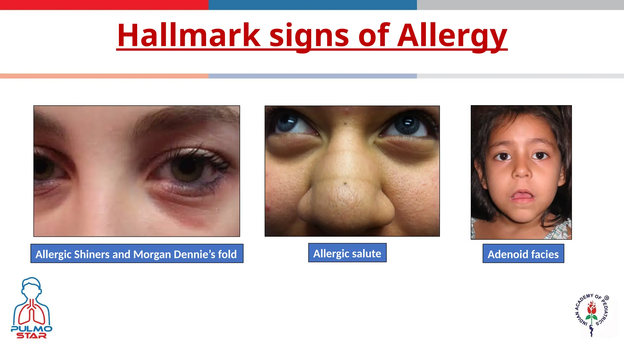 "Persistent and Recurrent Cough: Causes, Diagnosis, and Management in ...