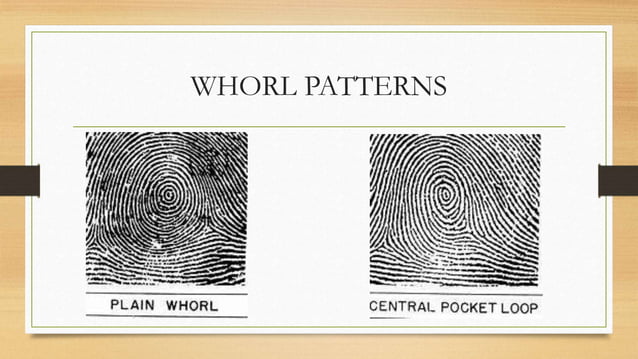 PERSONAL IDENTIFICATION TECHNIQUES.pptx | Skin and Dermatology ...