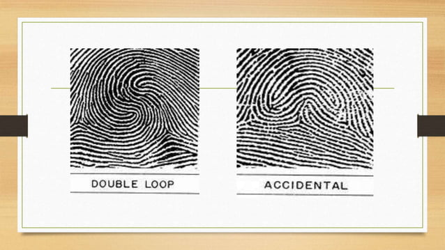 PERSONAL IDENTIFICATION TECHNIQUES.pptx | Skin and Dermatology ...
