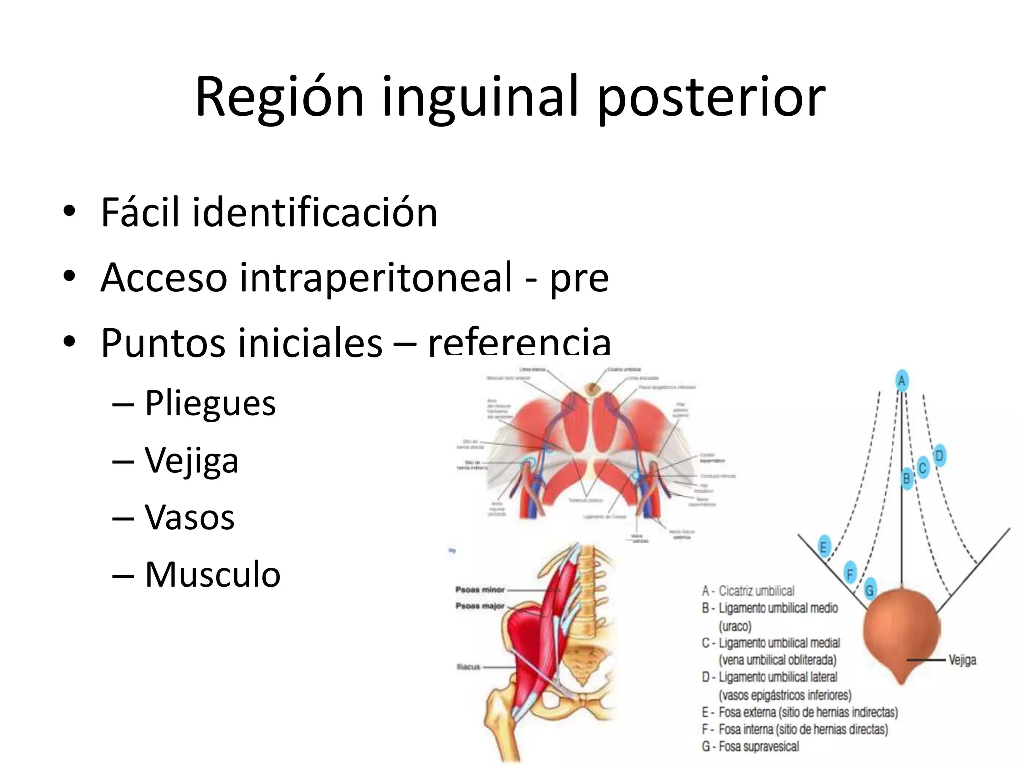 Perspectiva posterior hernias inguinales | PPT