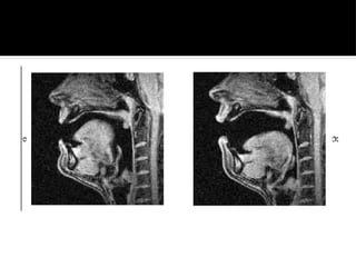 To articulate a vowel sound, the tongue, jaw and lips are placed to create a tube between larynx ...