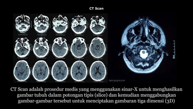 Pertemuan 1 Pemanfaatan Radiasi di Medis.pptx