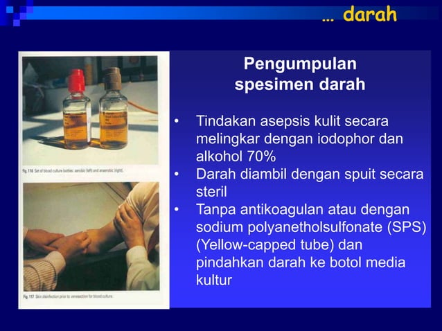Pertemuan 2. PENGELOLAAN SPESIMEN UNTUK PEMERIKSAAN MIKROBIOLOGI.ppt