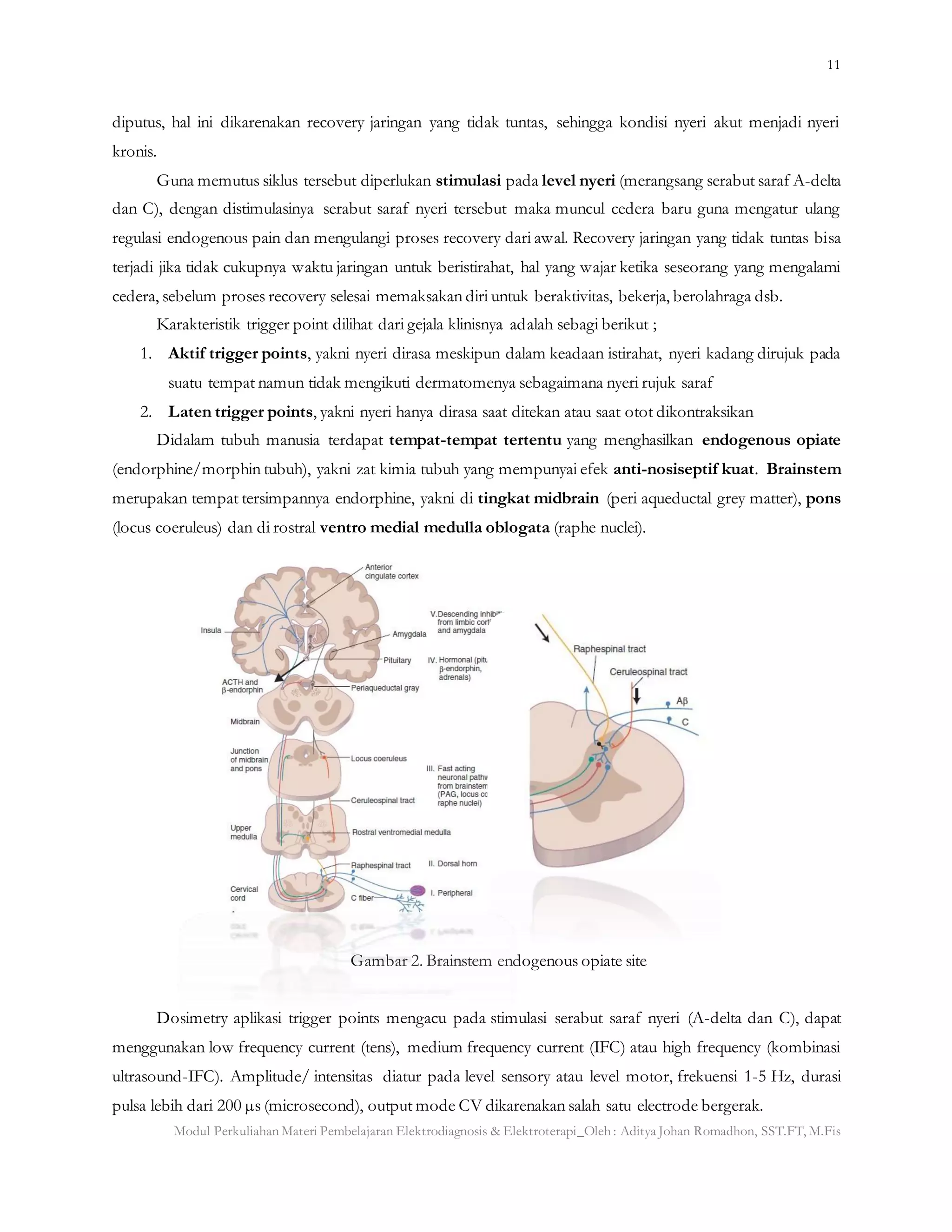 Modul Trigger Points | PDF
