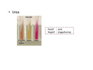 Pertemuan 3 ISOLASI DAN IDENTIFIKASI Bacillus sp.pptx