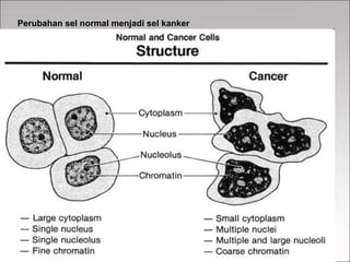 Pertemuan keempat belas (a) kanker-ppt.ppt