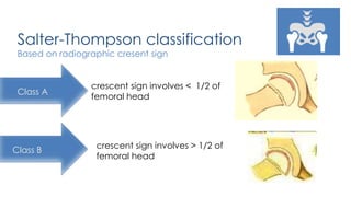 legg calve Perthes disease | PPTX