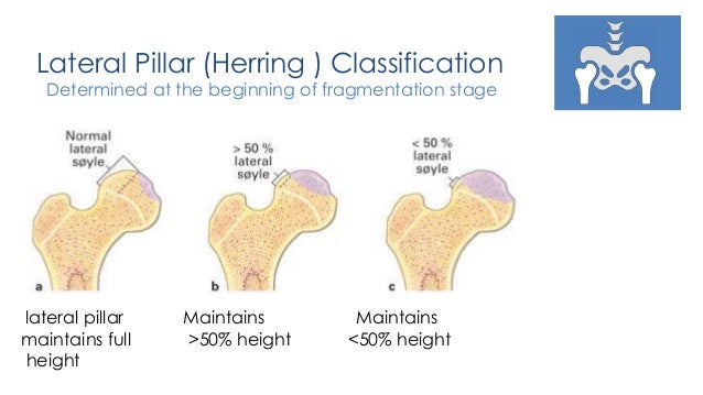 legg calve Perthes disease