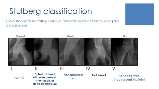legg calve Perthes disease