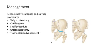 Perthes disease | PPT