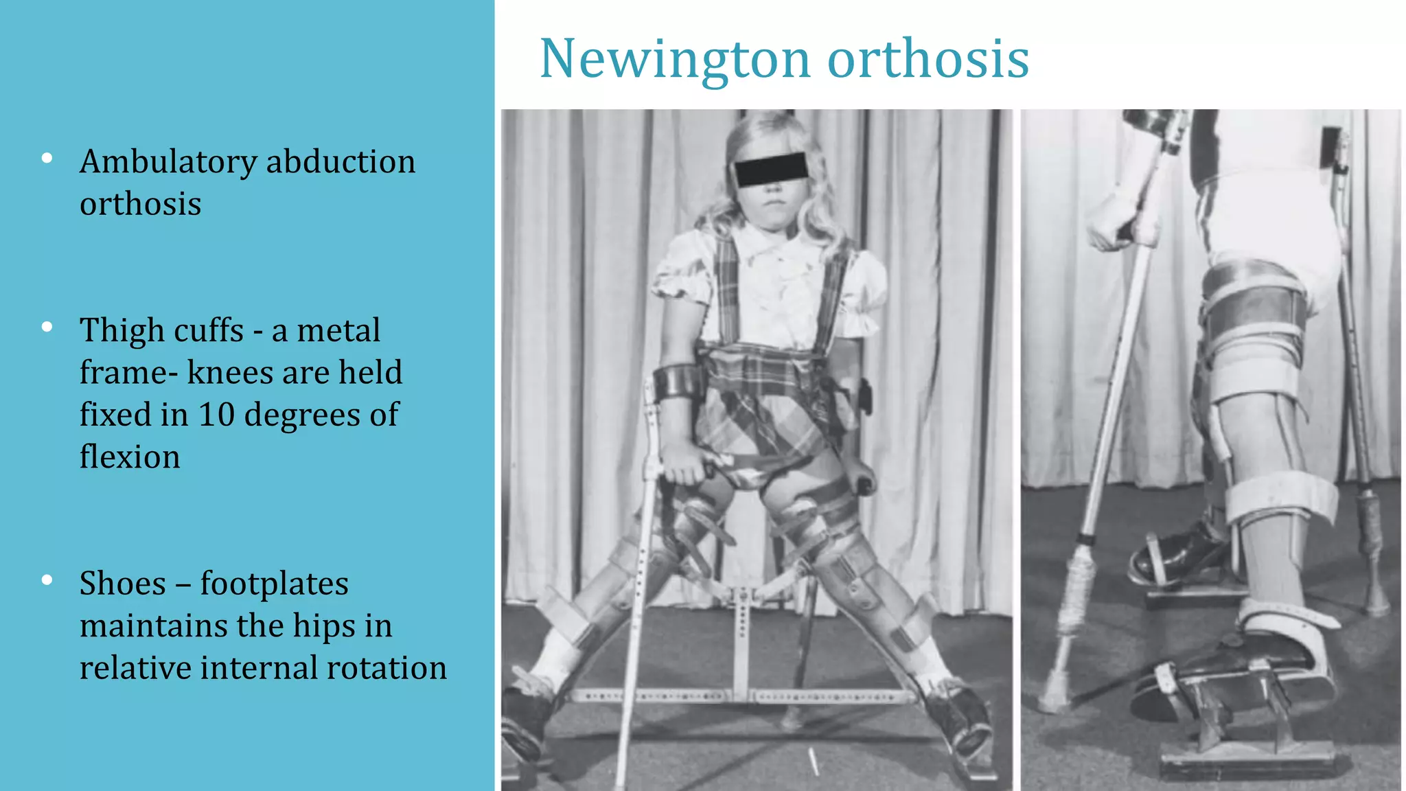 Legg Calve Perthes disease | PPTX