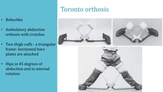 Legg Calve Perthes disease | PPTX