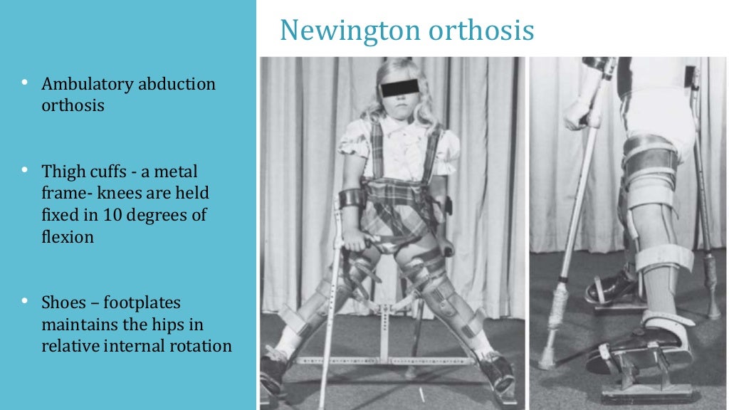 Legg Calve Perthes disease