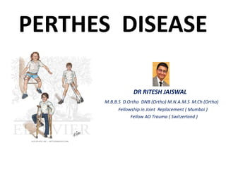 PERTHES DISEASE | PPTX