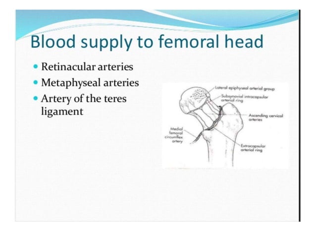Perthes disease | PPT