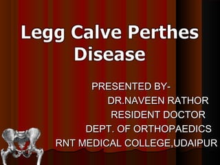 Perthes disease by DR.NAVEEN RATHOR | PPT