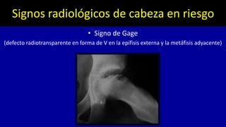 Enfermedad de Perthes/Pseudoartrosis del cuello femoral | PPTX