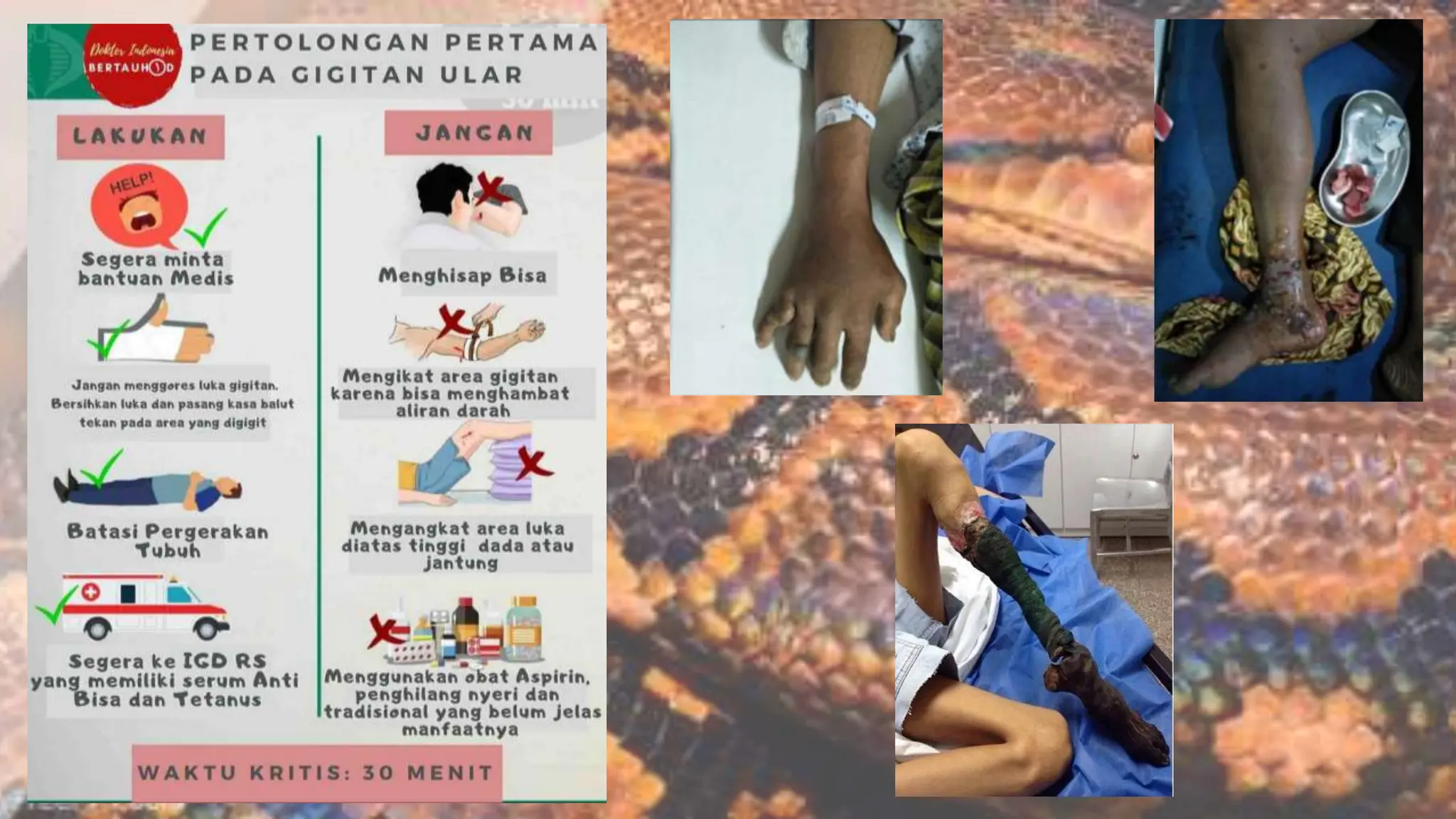 pertolongan pertama bisa ular.pptx