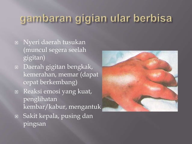 Pertolongan pertama pada gigitan ular | PPTX