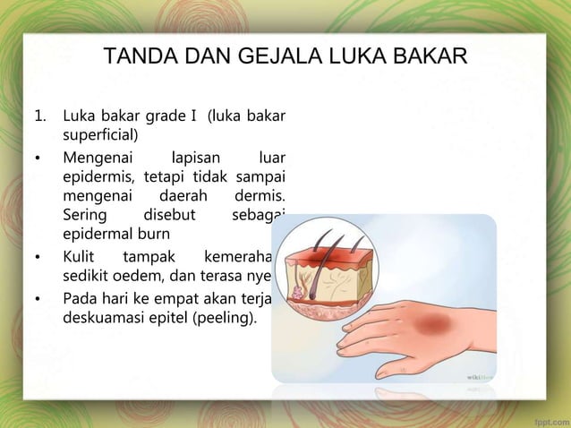 pertolongan_pertama_pada_luka_bakar.pptx