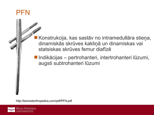 Femur pertrohantera lūzuma ārstēšanas metodes - PFN pret DHS debate | PPT