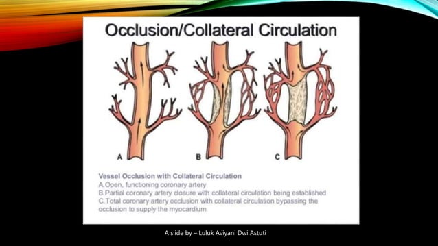 Pertumbuhan Kolateral Koroner dengan Latihan Fisik | PPT