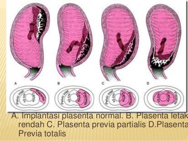Pertumbuhan plasenta dr.emminarty